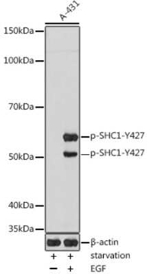 SHC1 [p Tyr427] Antibody (NBP3-16938): Novus Biologicals